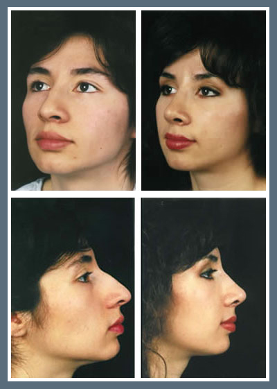 Keys to Finding a Great Surgeon - The Plastic Surgery Channel